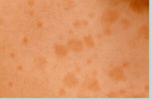 Black Neck: 7 Causes and How to Get Rid of it