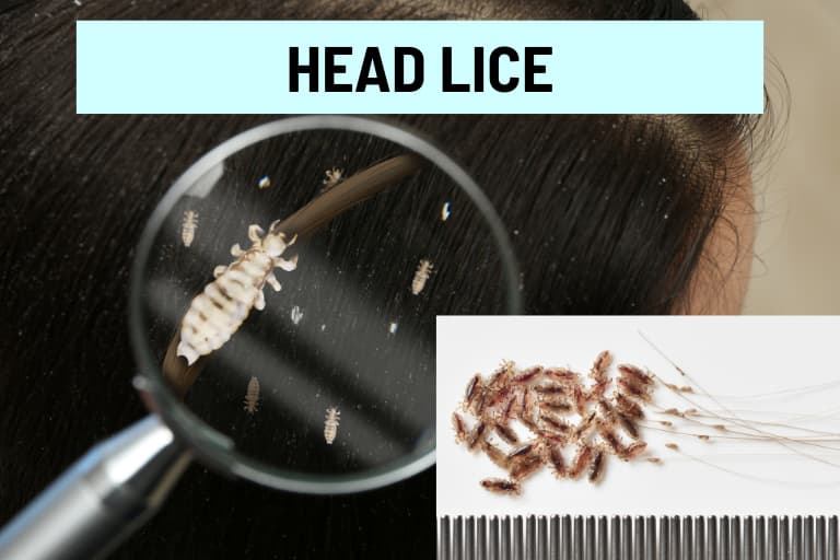 Red Spots On Scalp 11 Causes Pictures And Treatment Red Spots On Scalp 11 Causes Pictures And Treatment