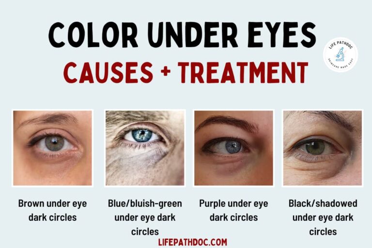 What Do Under-Eye Colors Mean? (Purple, blue, brown & black)