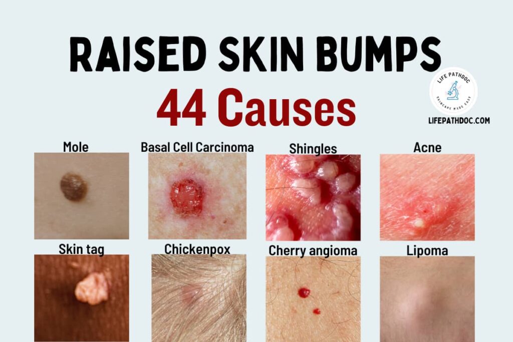 Life Pathdoc Skincare Basics Skin Health And Haircare Life Pathdoc Skincare Basics Skin Health And Haircare